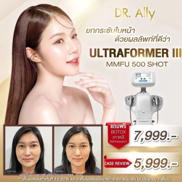 โปรแกรมULTRAFORMER III